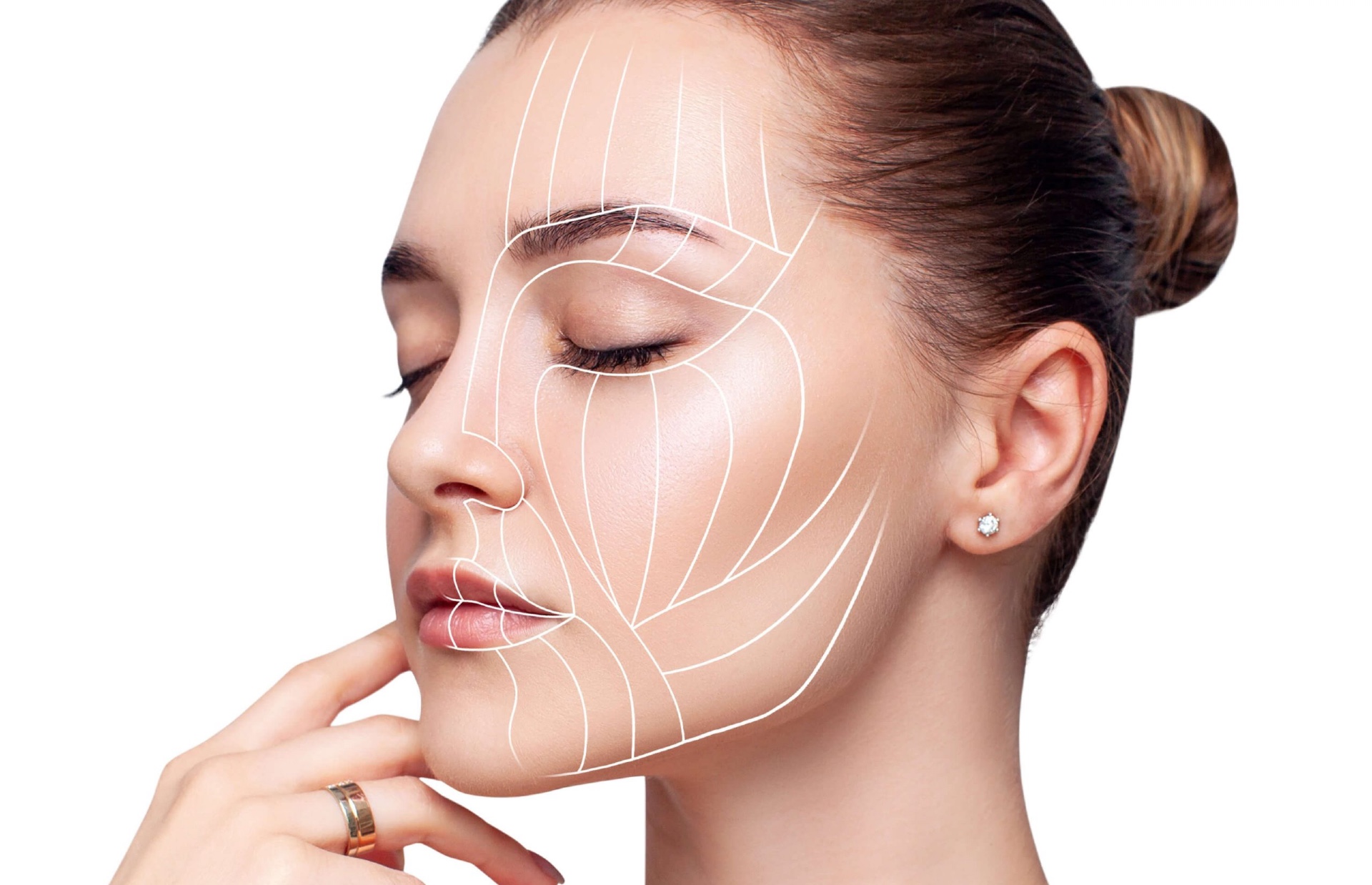 Exploring Endolift: A Minimally Invasive Approach to Facial ...